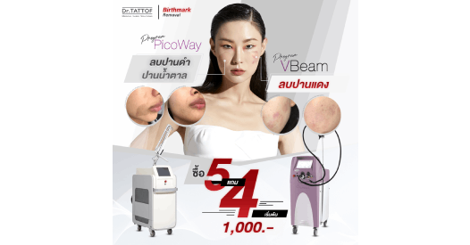 Birthmark removal ลบปานด้วย Program PicoWay Laser - THE PROMENADE